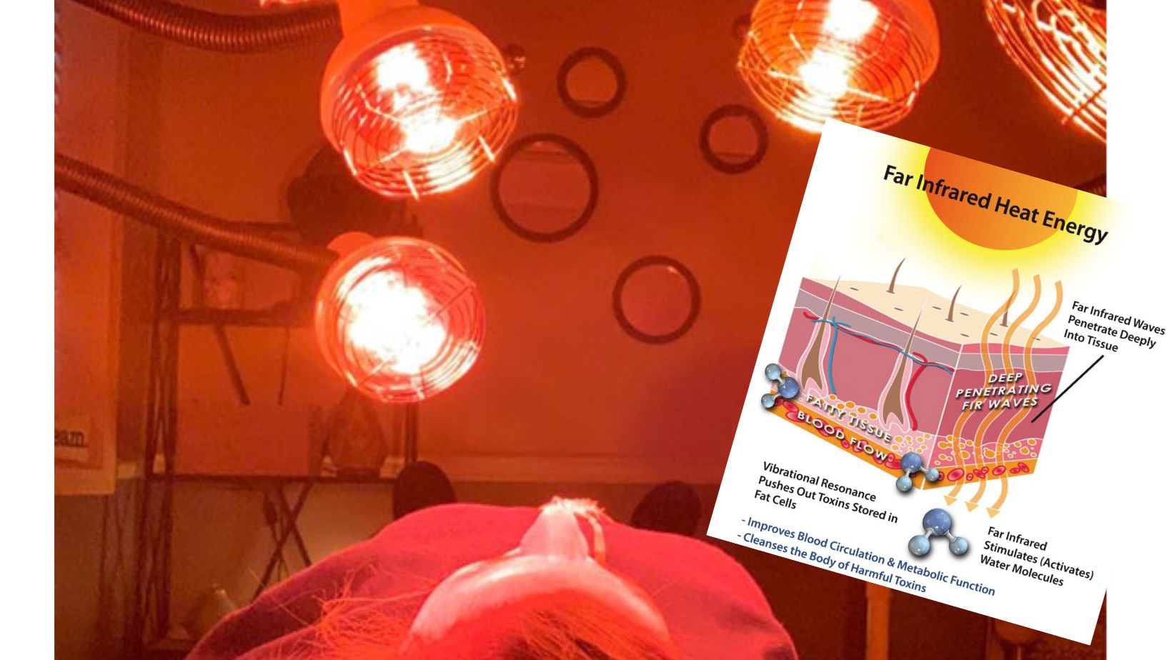 Thérapie par les infra-rouges lointains